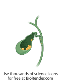 Free Gallbladder (with gallstones) Icons, Symbols & Images | BioRender