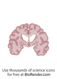 Free Brain (coronal cut, at basal ganglia, Huntington's disease) Icons ...