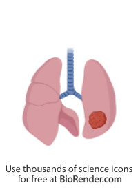 Free Mouse lung (with tumor) Icons, Symbols & Images | BioRender