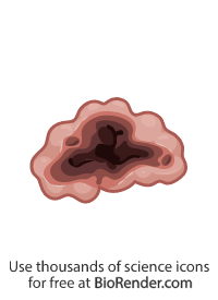 Free Tumor (squished, necrosis 2) Icons, Symbols & Images | BioRender