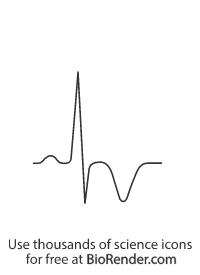 Free ECG tracing (apical hypertrophic cardiomyopathy) Icons, Symbols ...