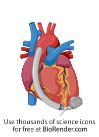 Free Heart (left ventricular assist device) Icons, Symbols & Images ...