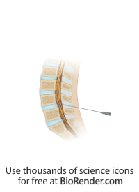 Free Lumbar puncture Icons, Symbols & Images | BioRender