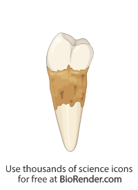 Free Tooth (premolar, severe periodontal disease, tooth only) Icons ...