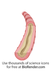 Free Airway (cystic fibrosis, cross-section) Icons, Symbols & Images ...