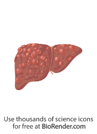 Free Liver (polycystic) Icons, Symbols & Images | BioRender