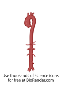 Free Aorta (with aneurysm of the ascending aorta) Icons, Symbols ...
