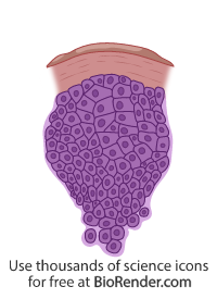 Free Basal cell carcinoma Icons, Symbols & Images | BioRender