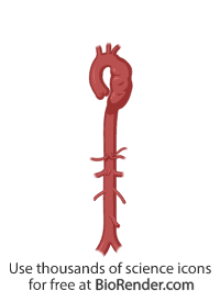 Free Aorta (with aneurysm of the descending thoracic aorta) Icons ...