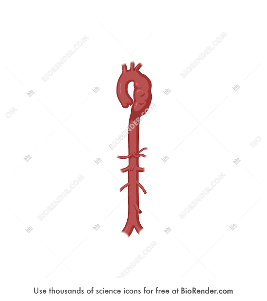 Free Aorta (with aneurysm of the descending thoracic aorta) Icons ...