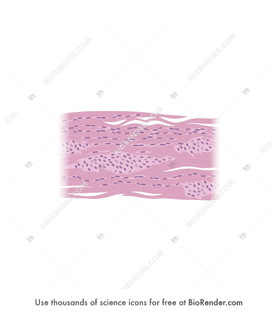 Free Tendon (longitudinal cross-section, fibrotic) Icons, Symbols ...