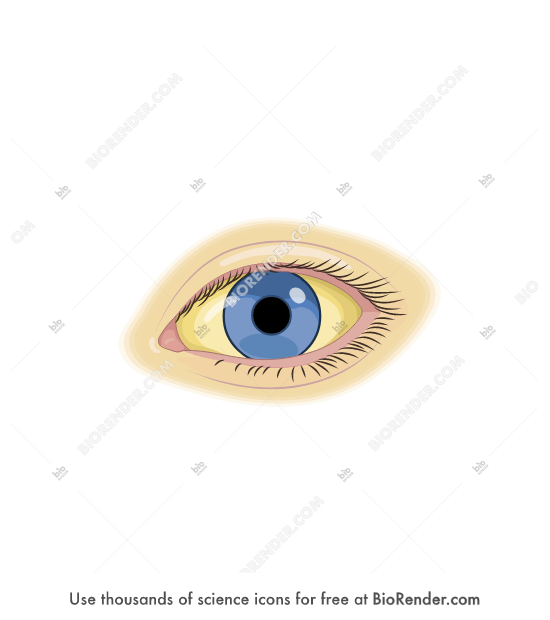 Free Jaundice (eye) Icons, Symbols & Images | BioRender