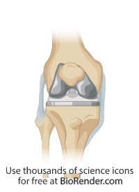 Free Total knee replacement (normal) Icons, Symbols & Images | BioRender