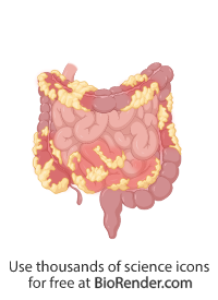 Free Ileocolitis Icons, Symbols & Images | BioRender