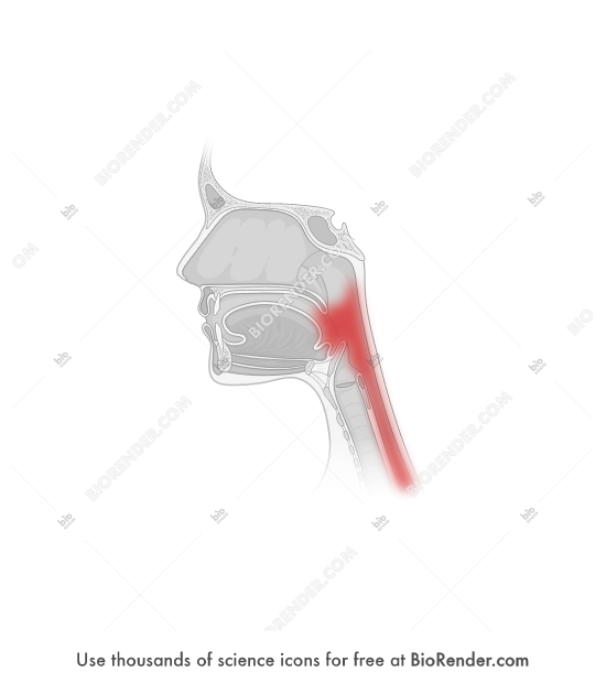 Free Pharyngitis (side) Icons, Symbols & Images | BioRender