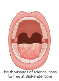 Free Mouth (oral thrush) Icons, Symbols & Images | BioRender