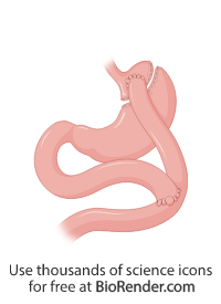 Free Roux-en-y gastric bypass Icons, Symbols & Images | BioRender