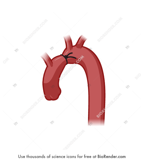 Free Transverse aortic constriction (TAC, mouse) Icons, Symbols ...
