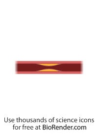 Free Blood vessel (cut, atherosclerosis) Icons, Symbols & Images ...