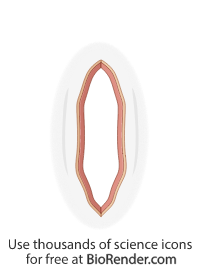 Free Open surgical incision 2 (human) Icons, Symbols & Images | BioRender
