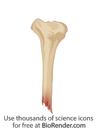 Free Tibial shaft fracture (complete, proximal half, anterior) Icons ...