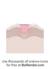 Free Skin (wound, healing) Icons, Symbols & Images | BioRender