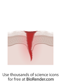 Free Skin (wound) Icons, Symbols & Images | BioRender