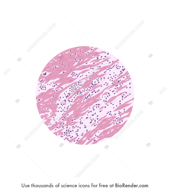 Free Cardiac tissue (myocarditis, cross-section) Icons, Symbols ...