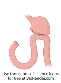 Free Billroth II gastrojejunostomy Icons, Symbols & Images | BioRender