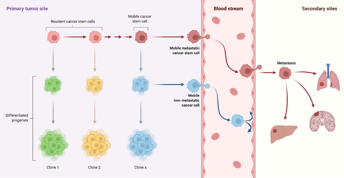 Metastasis Diagram