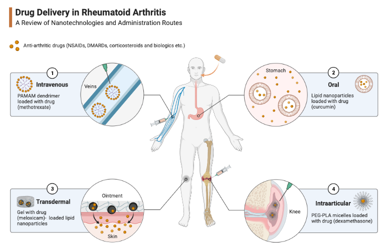 Drug Delivery in Rheumatoid Arthritis | BioRender Science Templates
