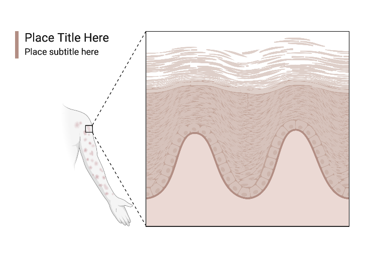 Arm with Rash and Callout (Layout) | BioRender Science Templates