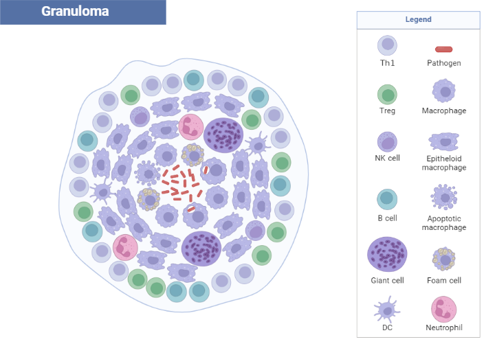 Granuloma | BioRender Science Templates