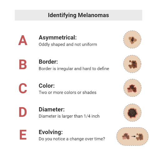 Identifying Melanomas | BioRender Science Templates