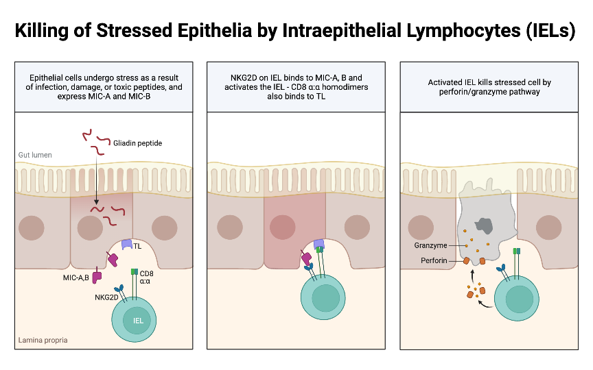 Killing of Stressed Epithelia by Intraepithelial Lymphocytes (IEL ...