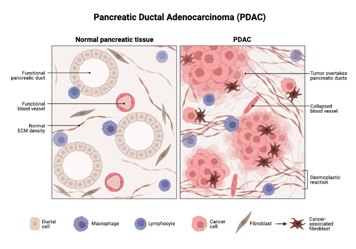 PDAC Histology | BioRender Science Templates