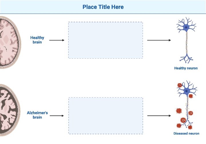 Comparison of Healthy Brain and Brain of Alzheimer's Patient (Layout ...