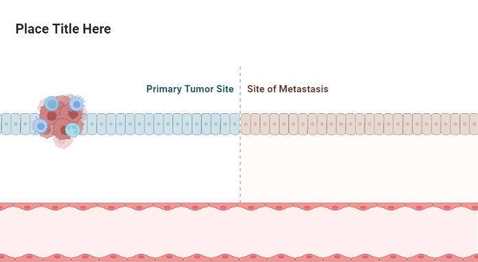 Tumor Metastasis (Layout) | BioRender Science Templates