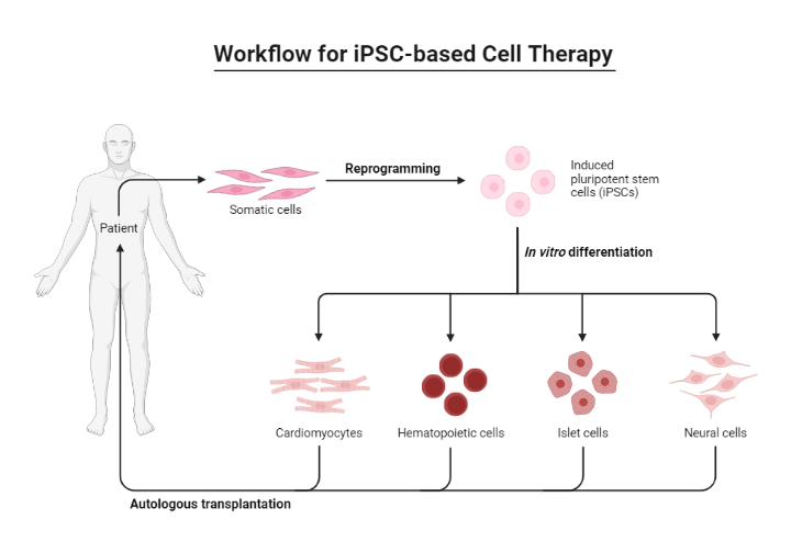 Workflow for iPSC-based Cell Therapy | BioRender Science Templates
