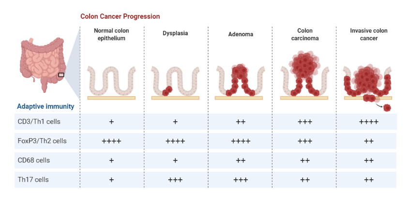 Adaptive Immunity During Colon Cancer Progression | BioRender Science ...