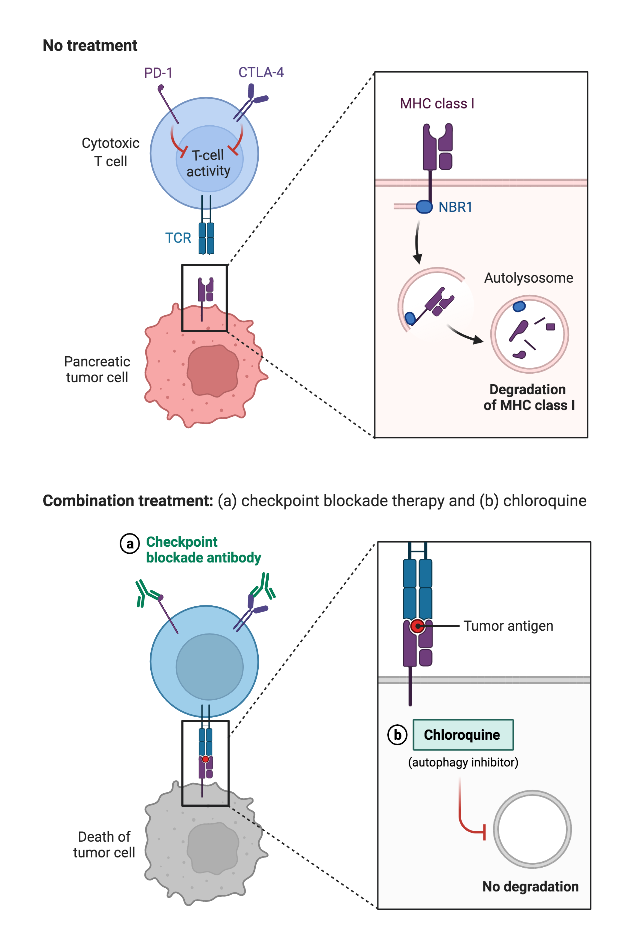 Combination Treatment of Pancreatic Cancer | BioRender Science Templates