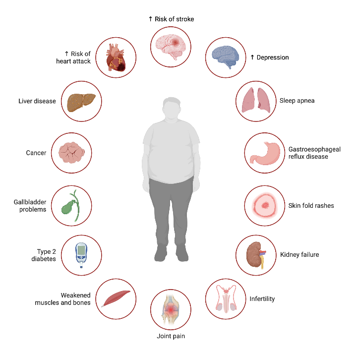The Effect of Obesity on the Body | BioRender Science Templates