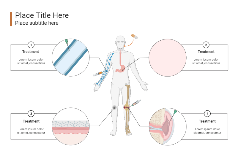 Drug Administration Routes with 4 Callouts (Layout) | BioRender Science ...
