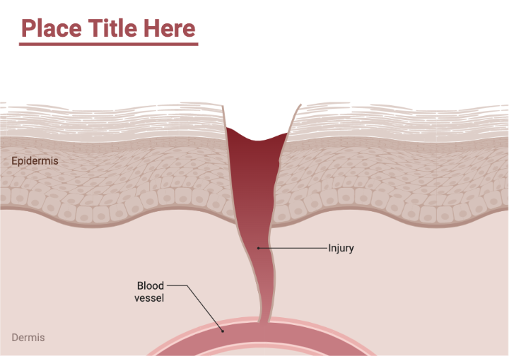 Skin with Injury (Layout) | BioRender Science Templates