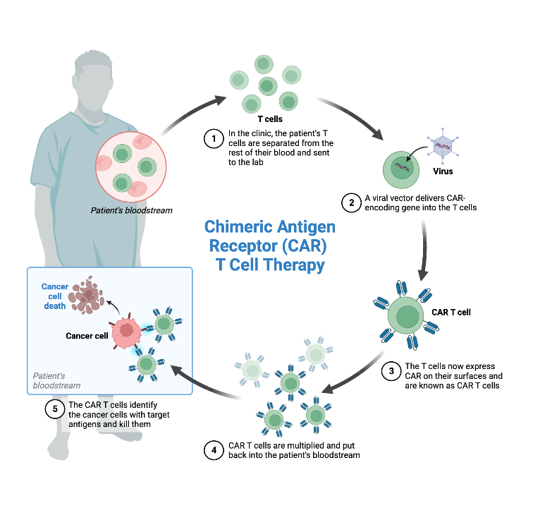 Chimeric Antigen Receptor (CAR) T Cell Therapy: Vein-to-Vein Process ...