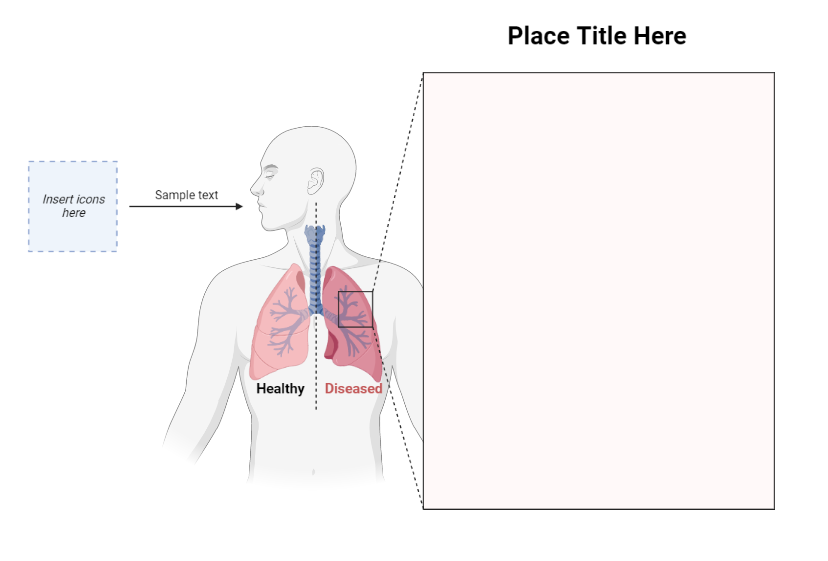 Healthy and Diseased Lung with Stimulus and Callout (Layout ...