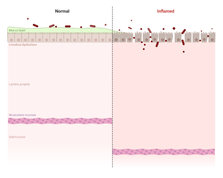 Compare and Contrast Layout - Healthy and Inflamed Epithelium ...