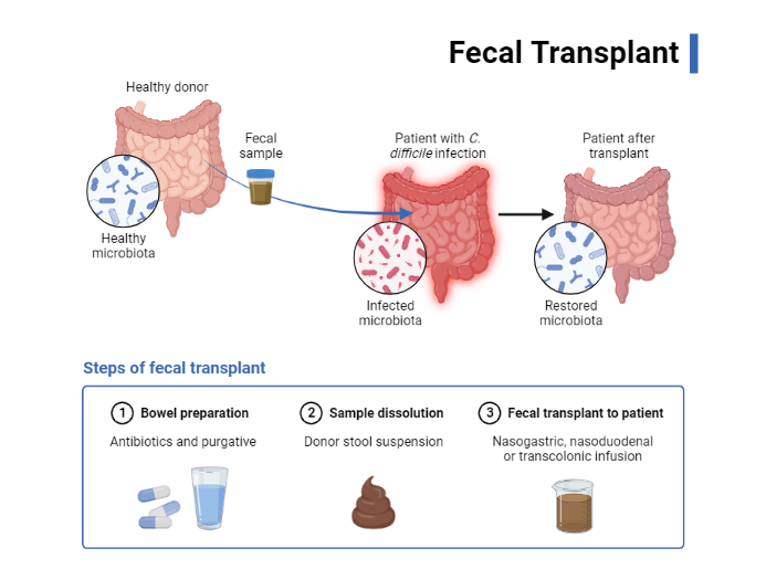 Fecal Transplant | BioRender Science Templates