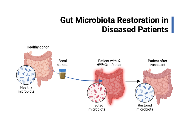 Gut Microbiota Restoration in Diseased Patients | BioRender Science ...