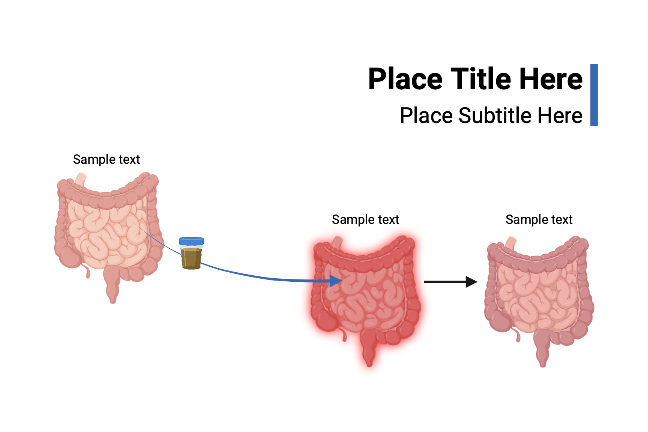Fecal Transplant with Gut (Layout) | BioRender Science Templates